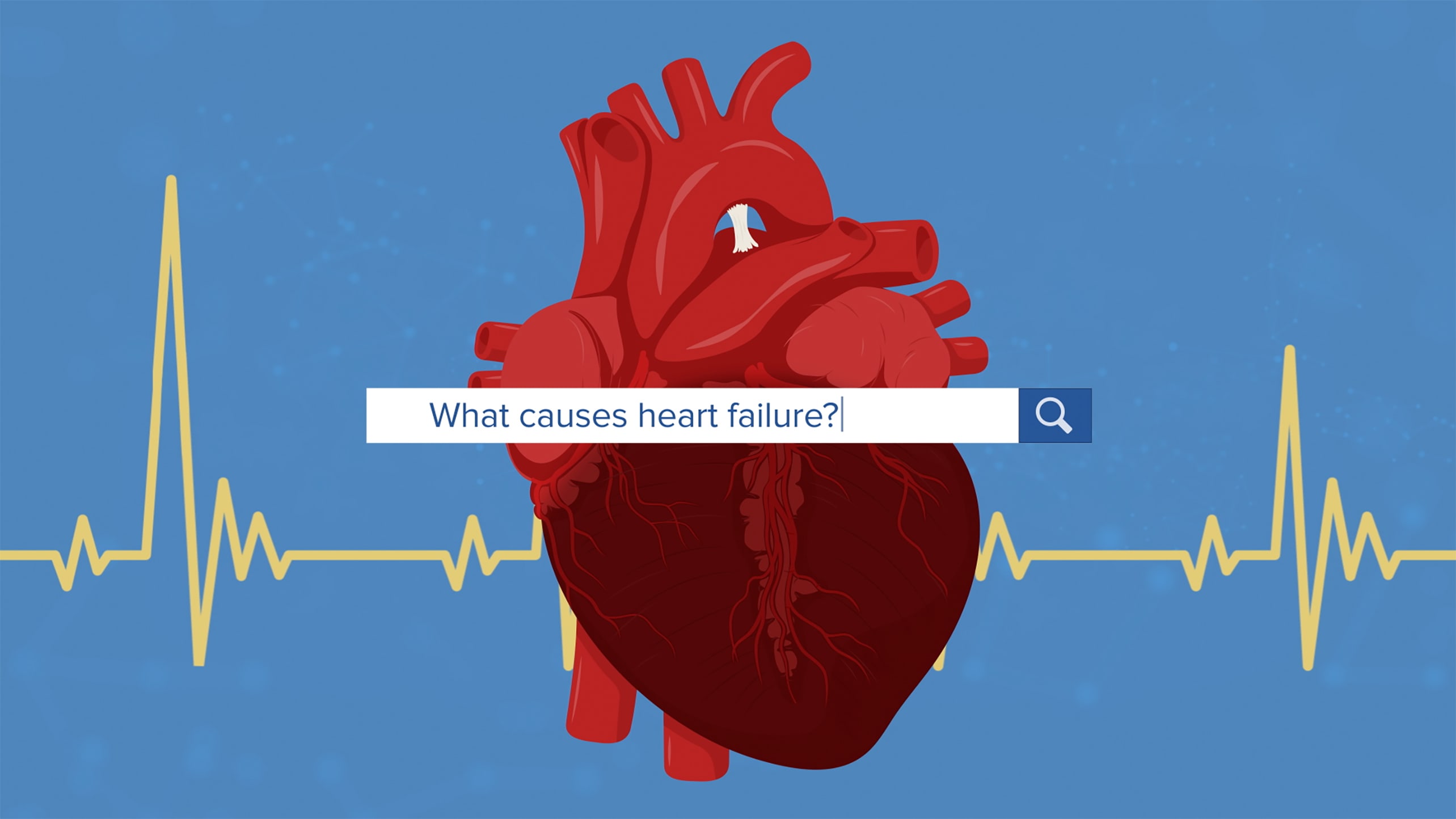 Congestive Heart Failure (CHF) > Fact Sheets > Yale Medicine