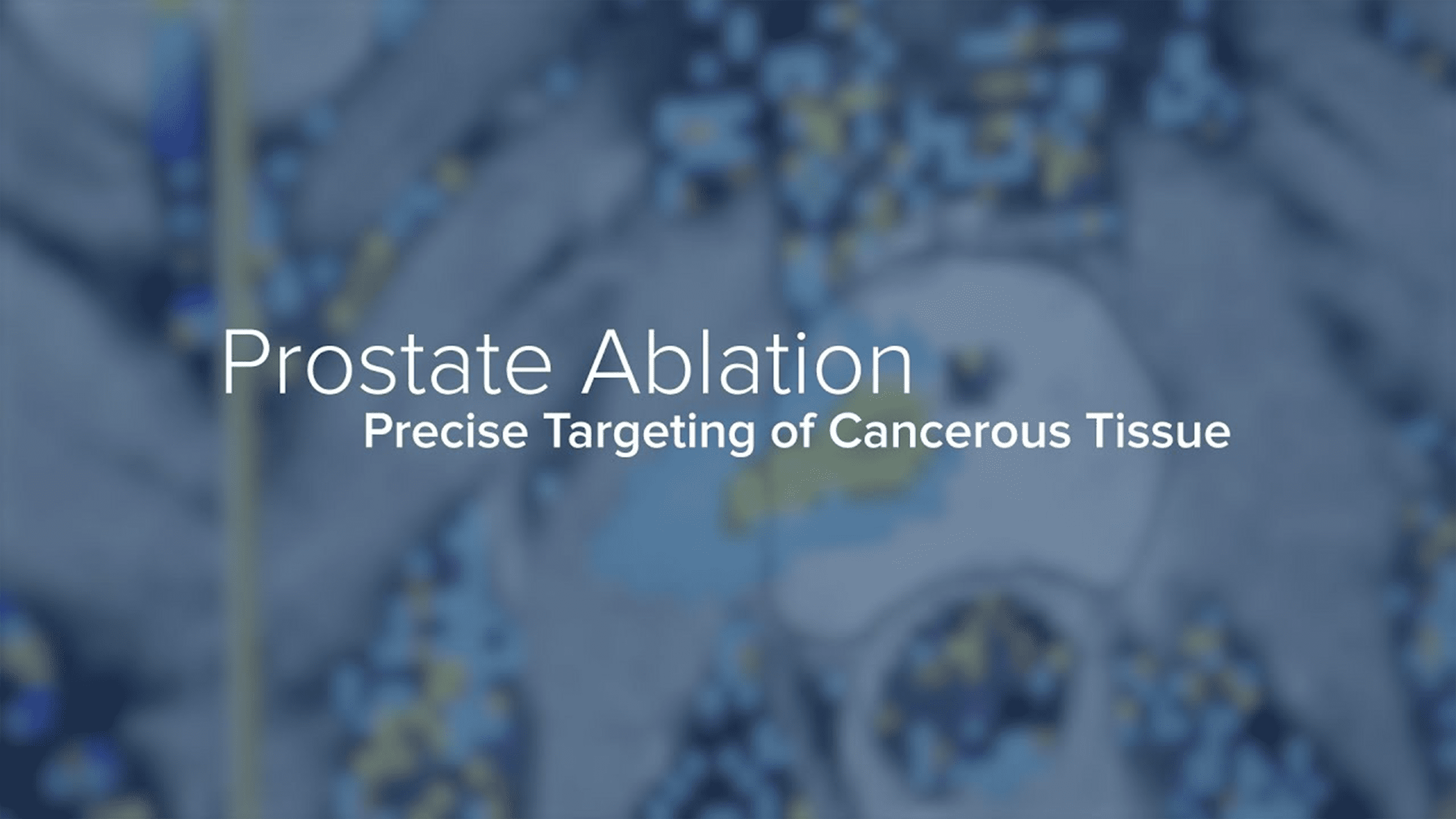 Urologic Cancers > Fact Sheets > Yale Medicine