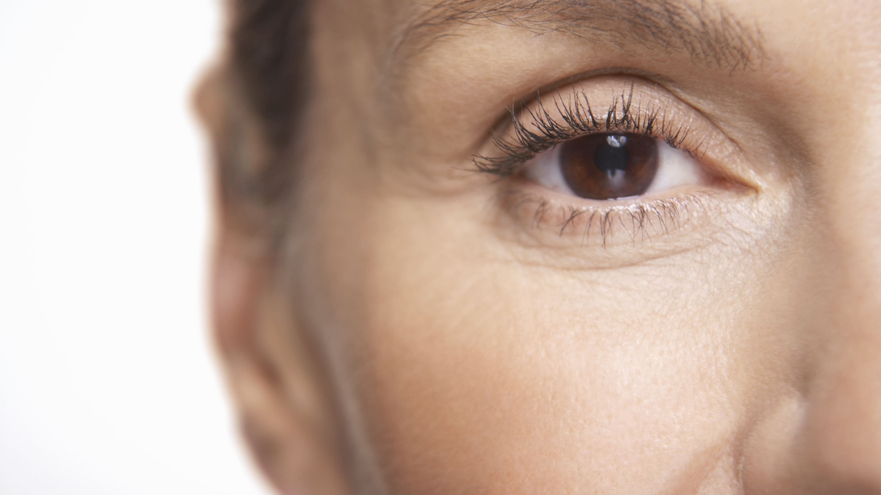 Adult Strabismus > Fact Sheets > Yale Medicine