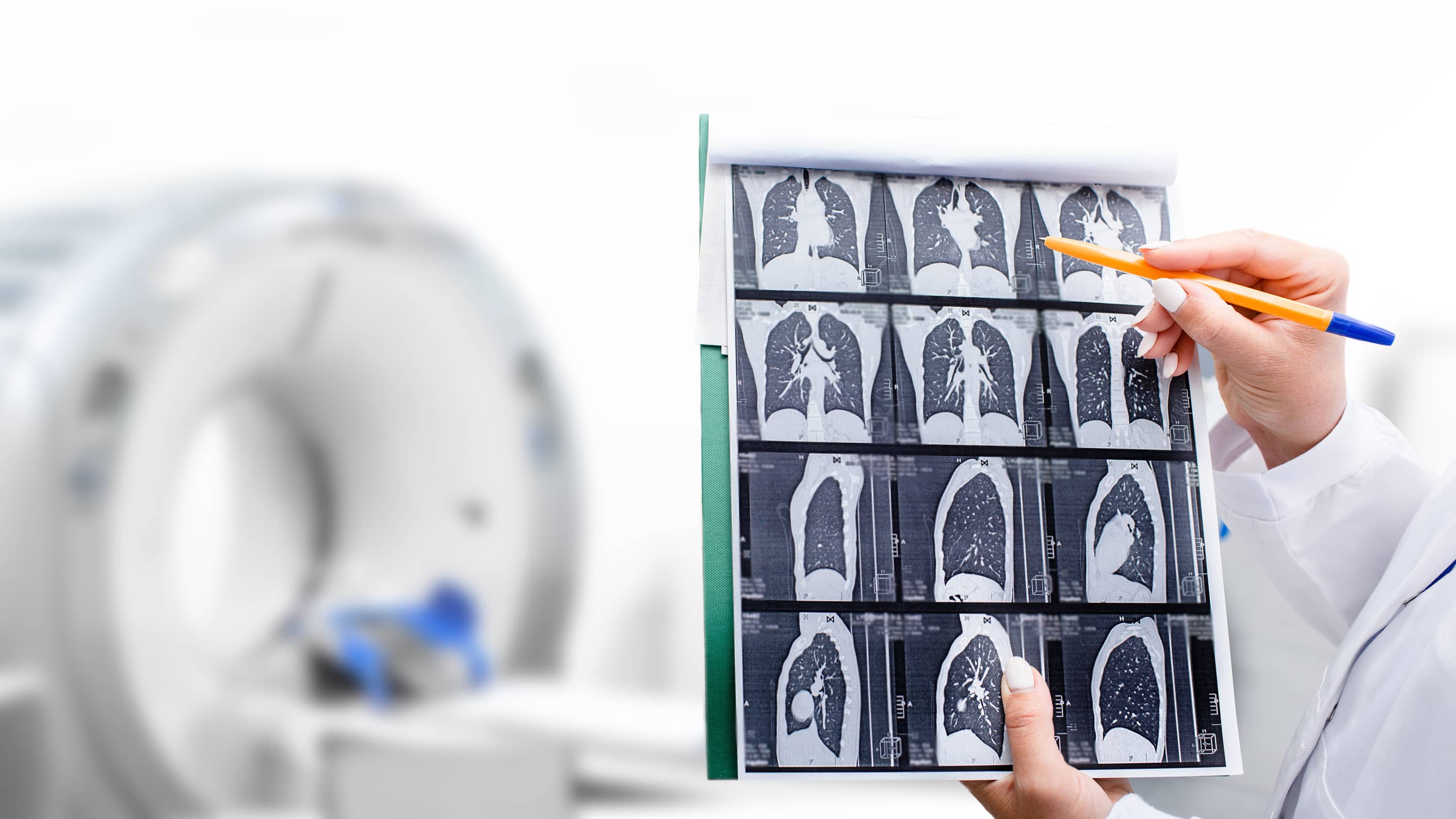3 Things to Know About Lung Cancer Screening > News > Yale Medicine