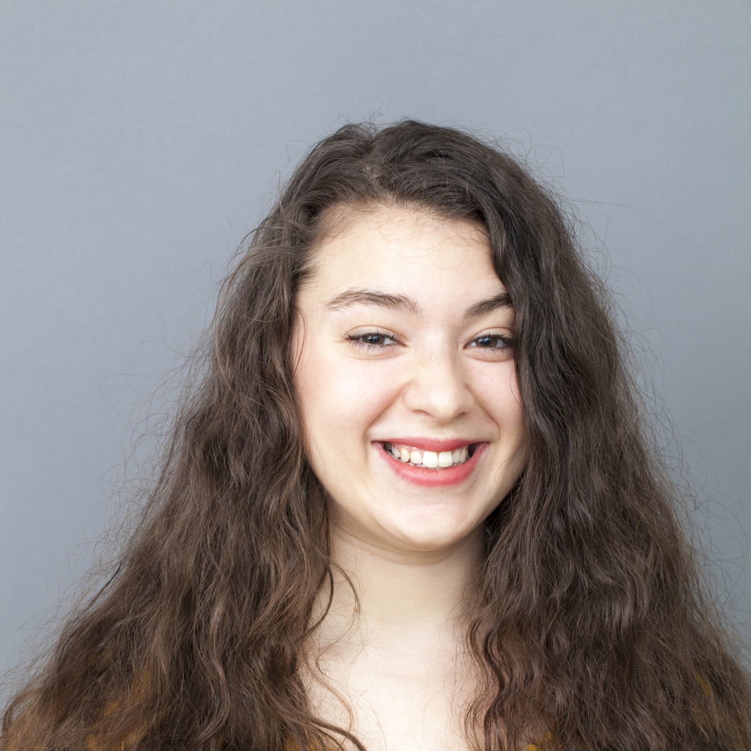 Polycystic Ovary Syndrome Hair
