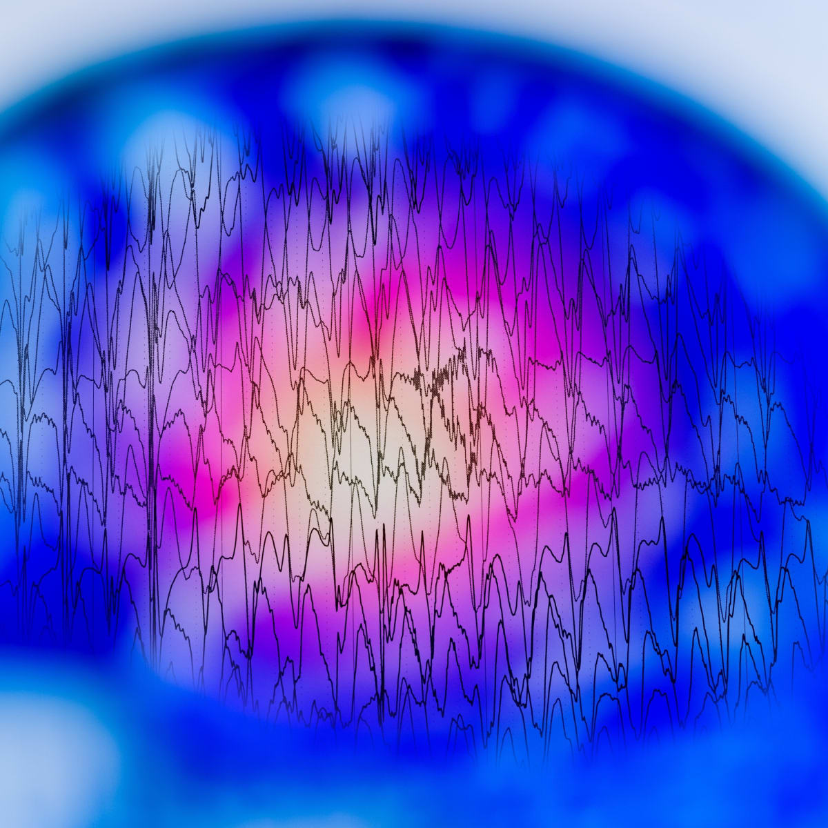 does epilepsy is curable