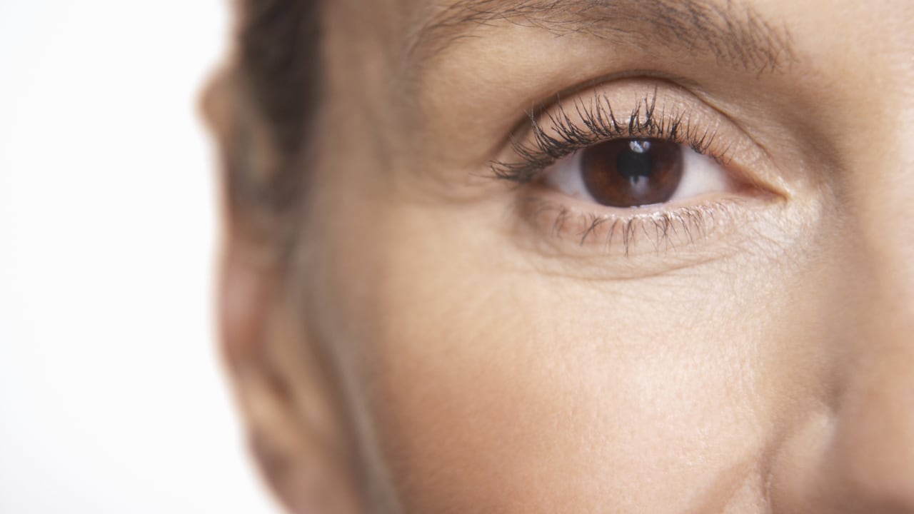 cross eyed operation