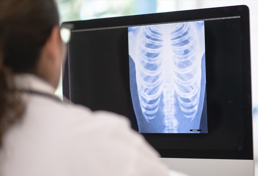 Screening & Prevention