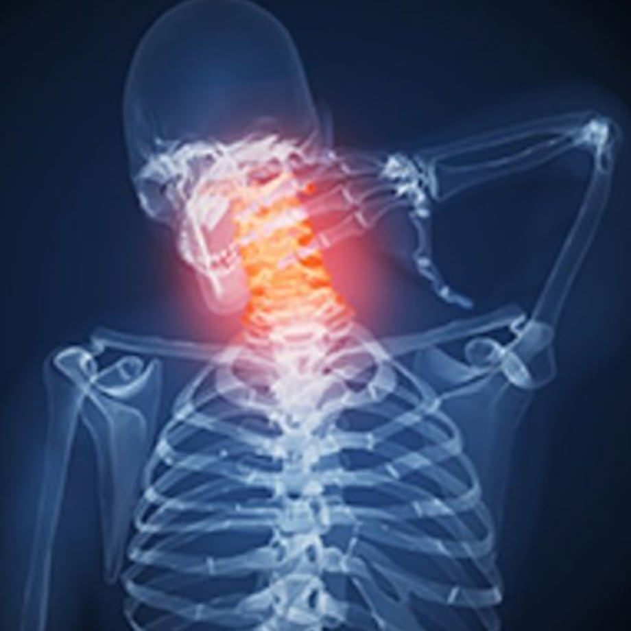 Yale Head and Neck Cancer Specialized Program of Research Excellence ... Yale Head and Neck Cancer Specialized Program of Research Excellence ...