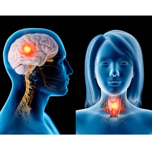 Researchers Develop a New Way to Classify HPV-Associated Head and Neck ...