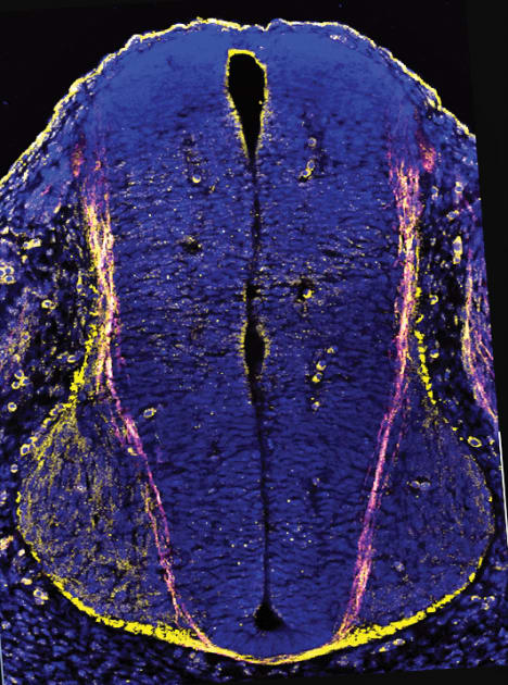 Biologists find molecule that guides axons