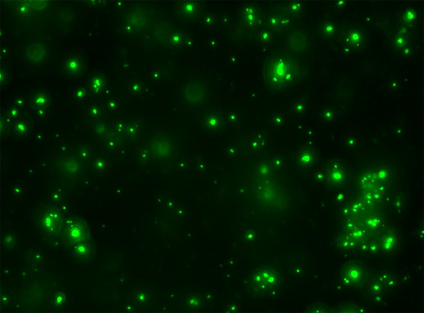 How Waste Build-Up in the Brain Occurs in Aging and Neurodegeneration ...