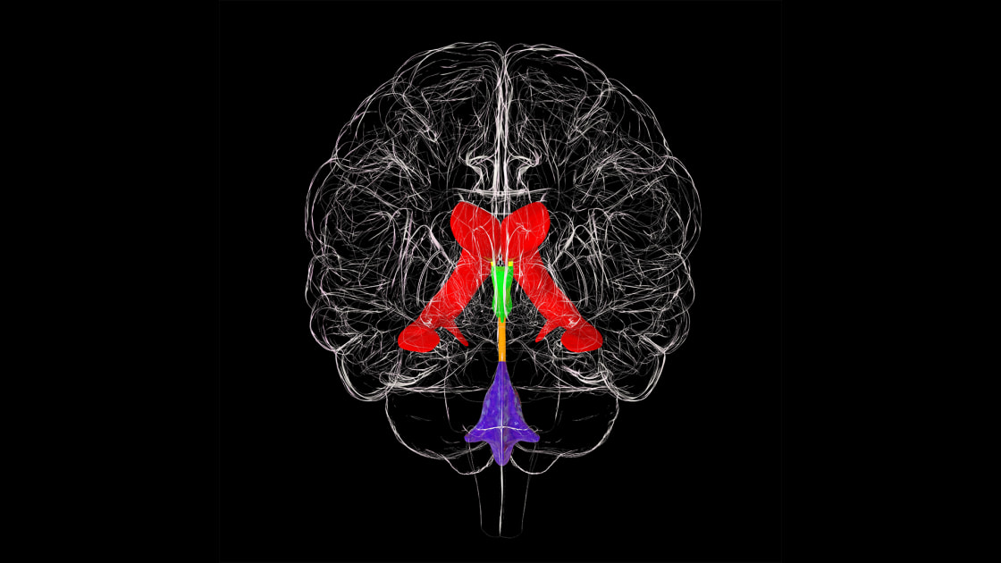 Brain Fog: New Study Examines Causes of This Long COVID Symptom | Yale ...