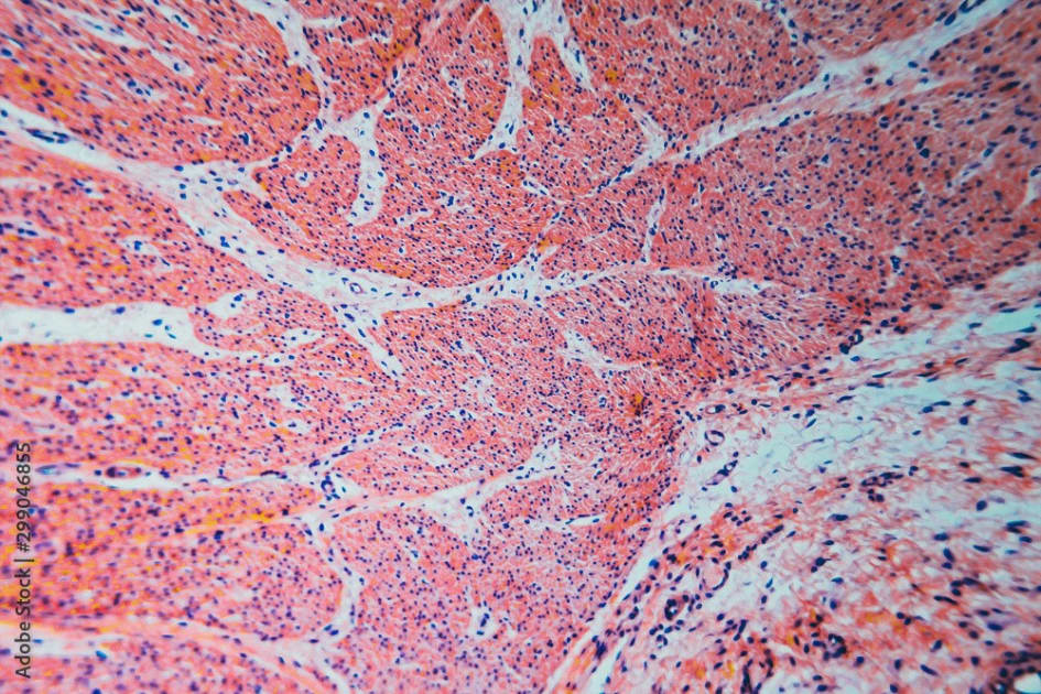 Yale Pathology Offers Anatomic Pathology and Anatomic Pathology ...