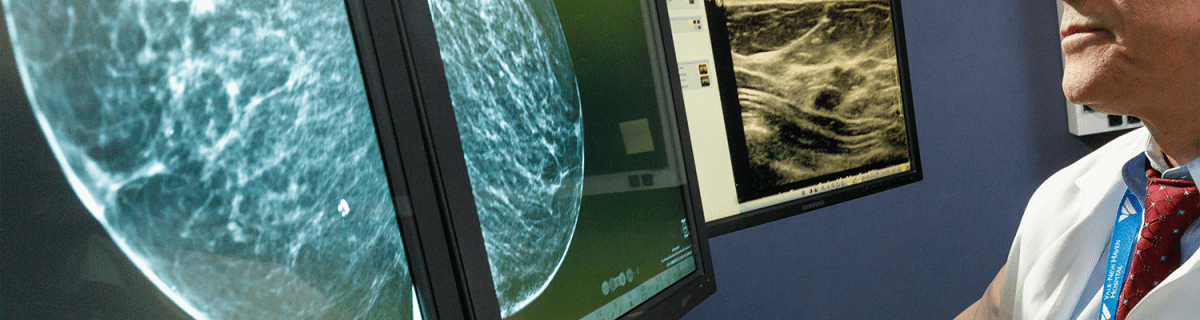 Breast Imaging | Radiology & Biomedical Imaging