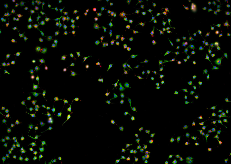 Reducing Cancer Burden Through Collaborative Research | Yale School of ...