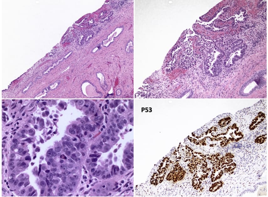 Yale Gynecologic Pathology