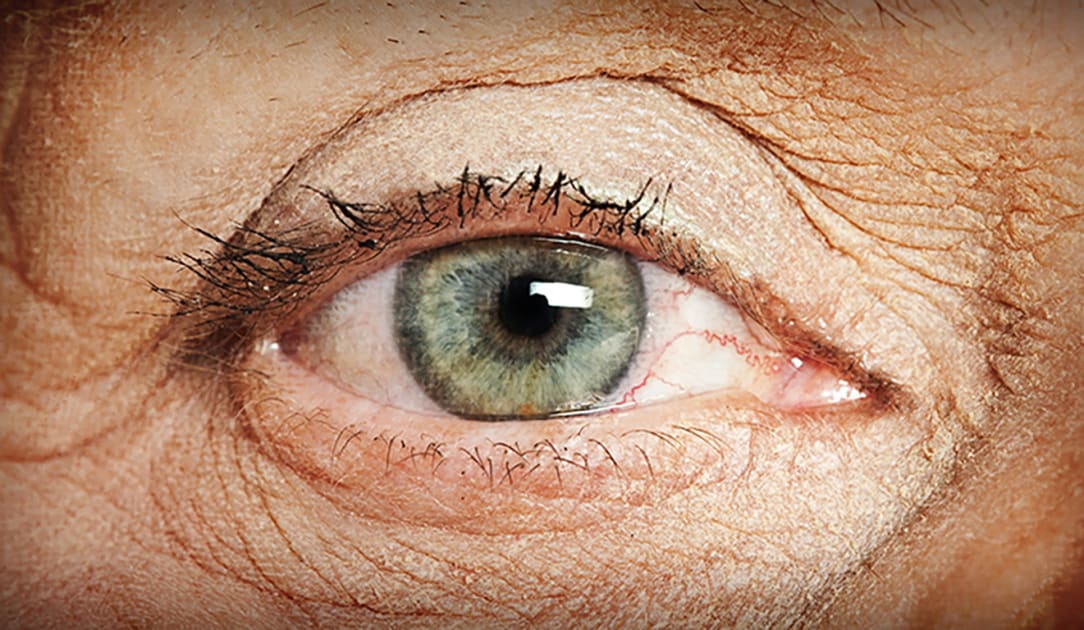 Yale team to search for ways to restore vision to the blind