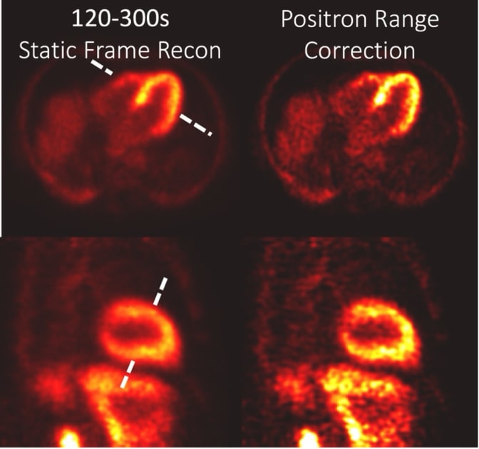 Heart | Yale Biomedical Imaging Institute