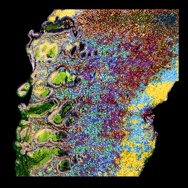 New Barcode Technology Could Help Diagnose Cancer More Precisely | Yale ...