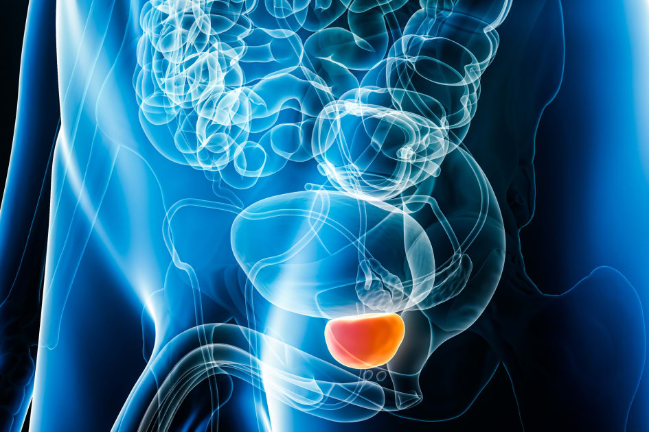 Breakthrough Study in Image-Guided Prostate Cancer Treatment | Yale ...