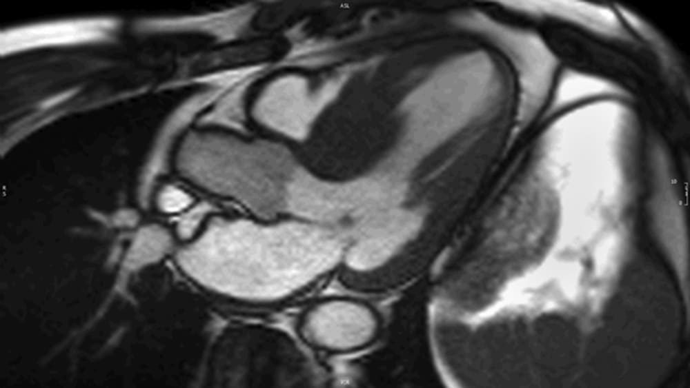 Cardiothoracic Imaging Fellowship | Radiology & Biomedical Imaging