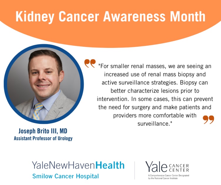 Joseph Brito III, MD, in Honor of Kidney Cancer Awareness Month