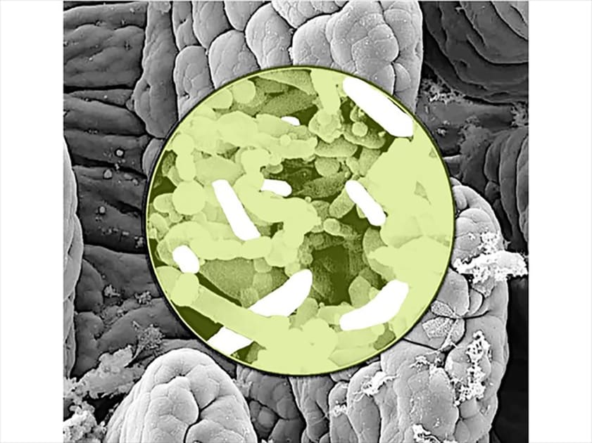 Microbiome Research at Yale | Microbial Pathogenesis