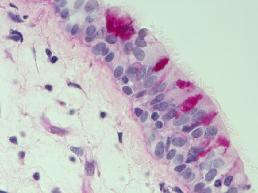 Epithelial Cell Biology