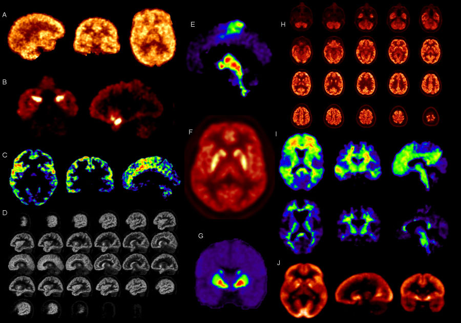The Neuroimaging Sciences Training Program in Substance Abuse | Yale ...