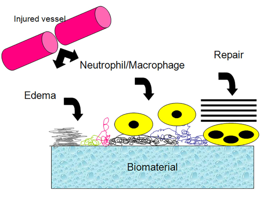 Molecular Events in the Foreign Body Response | Kyriakides Lab