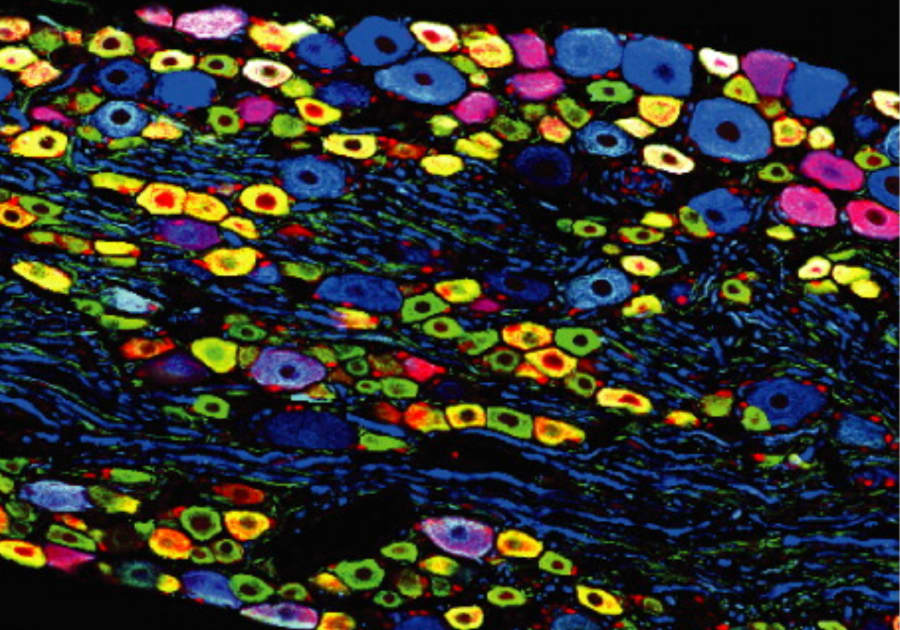 Clinical Trial Builds Upon Yale Studies to Provide Proof-of-Concept ...