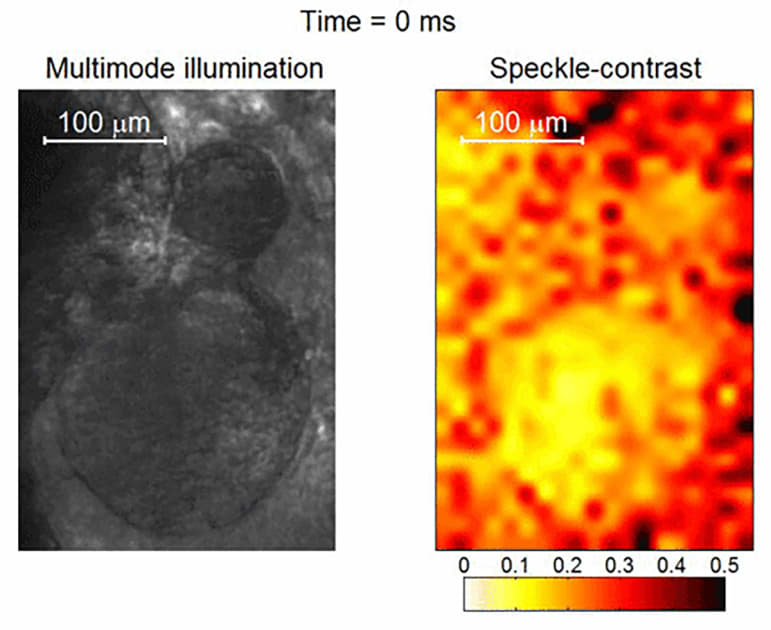 New laser gets to the heart of imaging