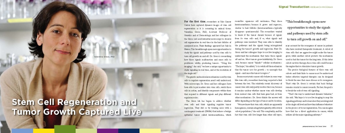 Stem Cell Regeneration and Tumor Growth Captured Live