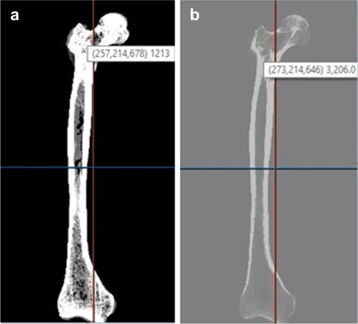 An open-access plug-in program for 3D modelling distinct material properties of cortical and ...
