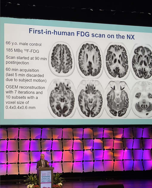 NeuroEXPLORER Images Unveiled at SNMMI | Yale School of Medicine