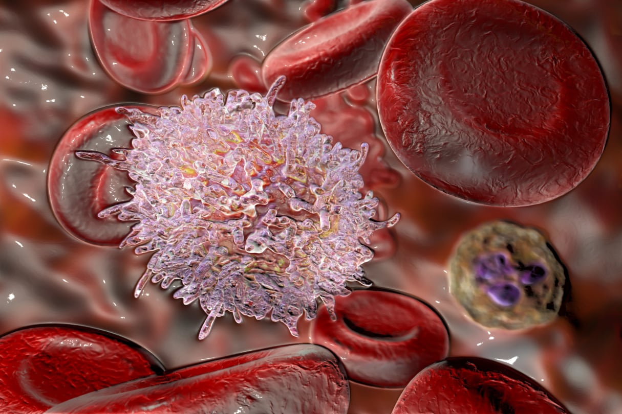 Leukemia, Lymphoma, and Multiple Myeloma: What to Know About Blood ...