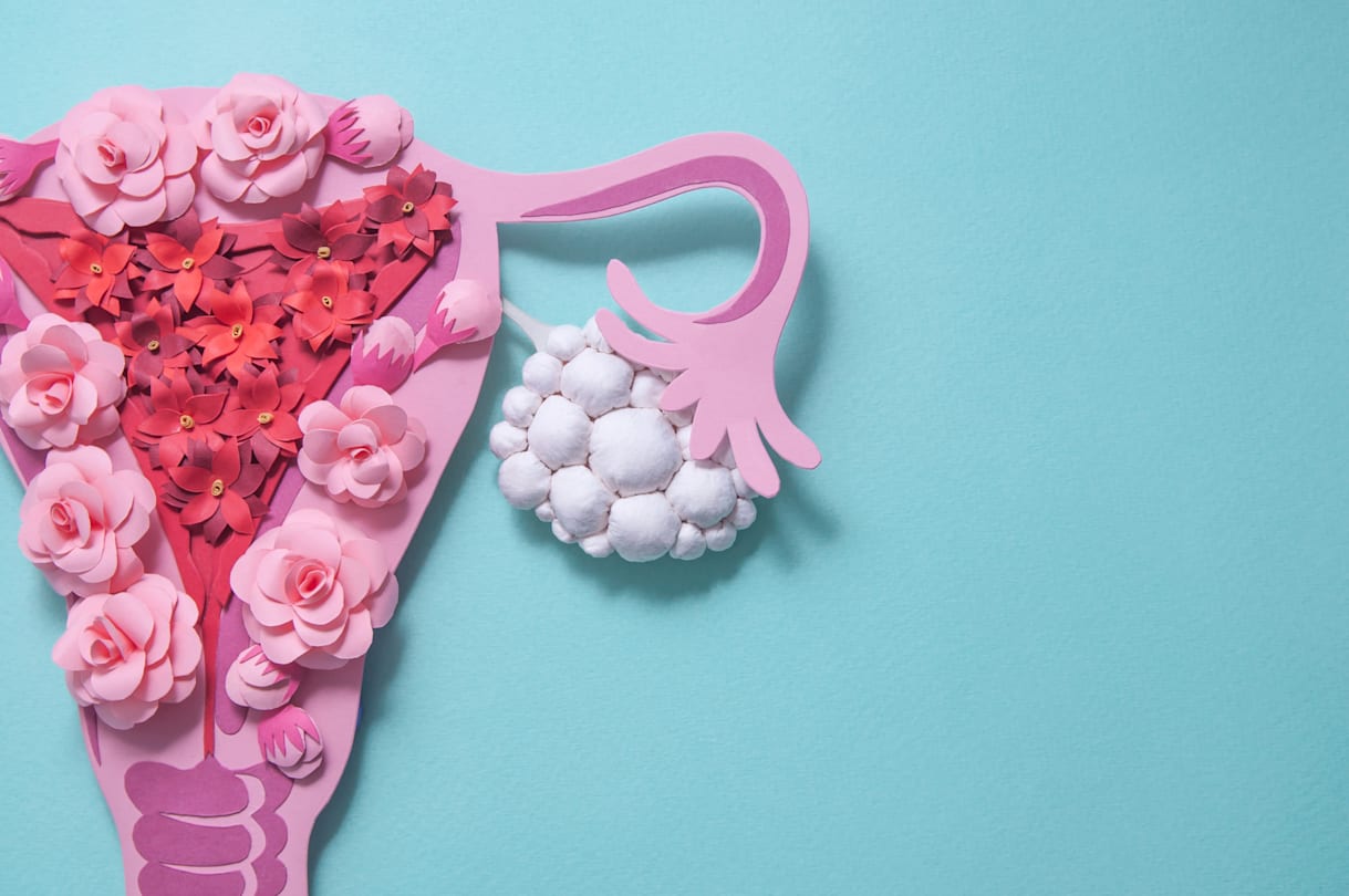 PCOS Is Renamed PMOS: What You Need to Know | News | Yale Medicine