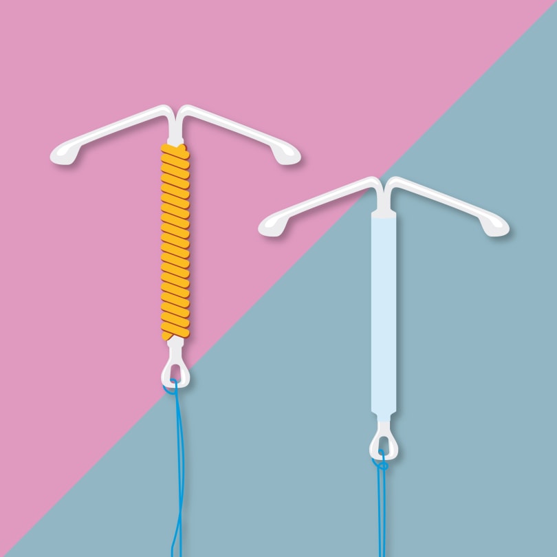 What Women Should Know About Intrauterine Devices (IUDs) | News | Yale ...