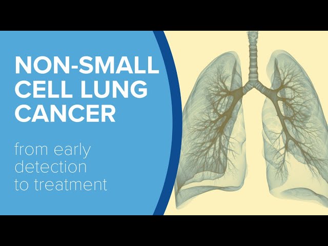 Non-Small Cell Lung Cancer - Yale Medicine Explains | Yale School of ...