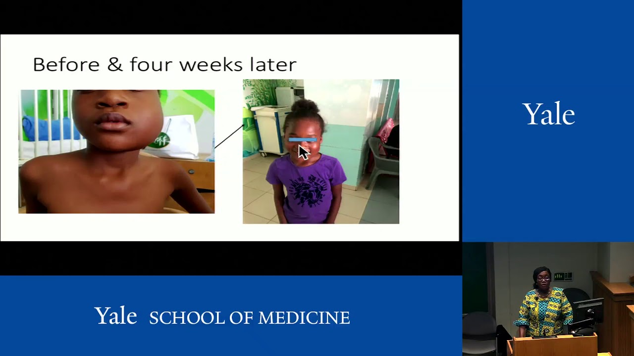 Lorna Awo Renner | Yale School of Medicine