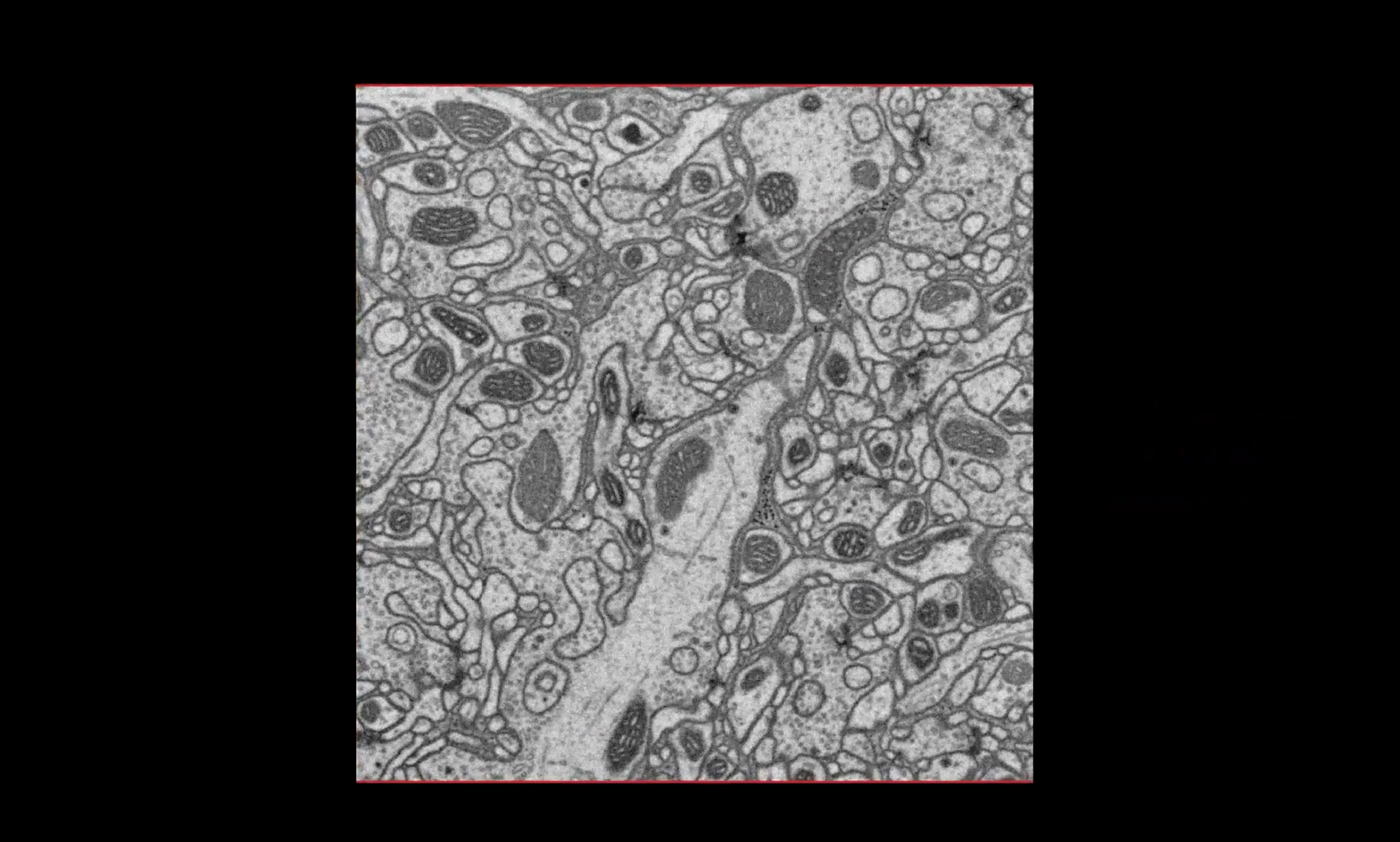 200x larger FIB-SEM volume at 4-nm voxels | Yale School of Medicine