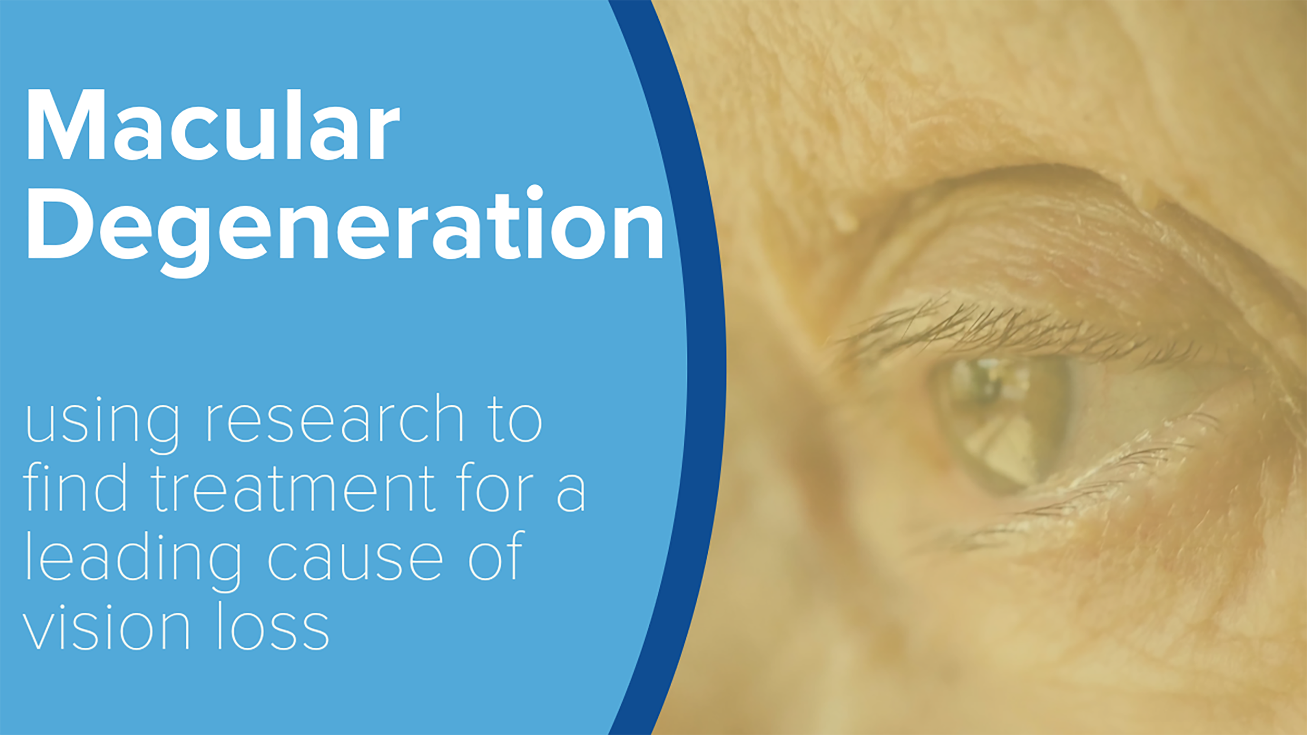 Macular Degeneration: How Yale Experts Treat This Common Cause of ...